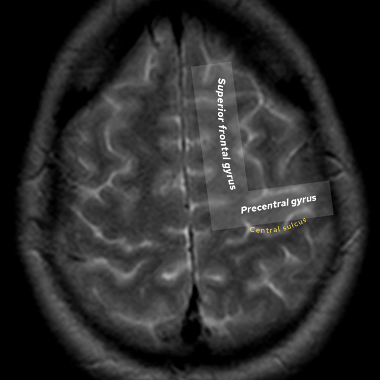 Anatomy quiz 1 – the Radiologist