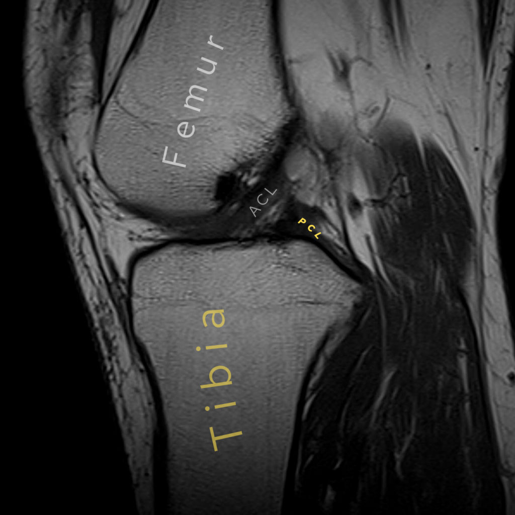 How to Read a Knee X-Ray | Anatomy and Alignment Guide