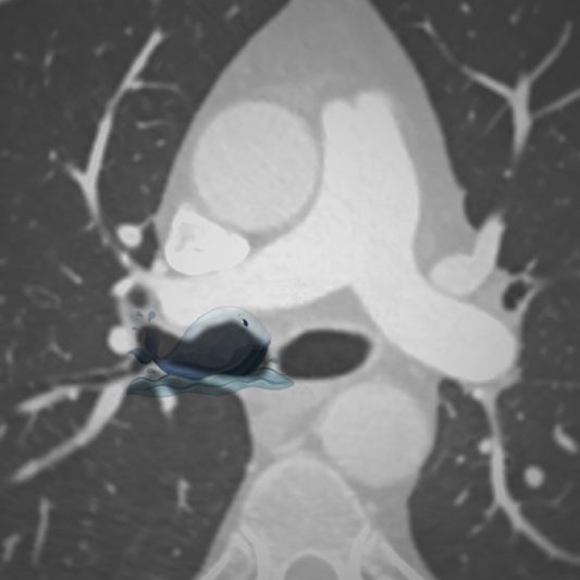 Anatomy quiz 1 – the Radiologist