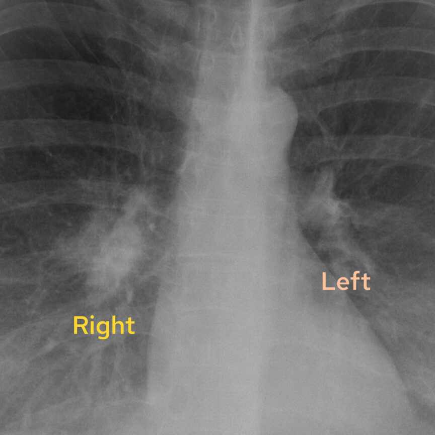 On call quiz 2 – https://theradiologist.co.uk
