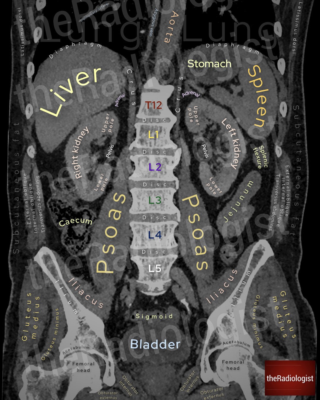How to Read an Abdominal X-ray | AXR Interpretation Guide