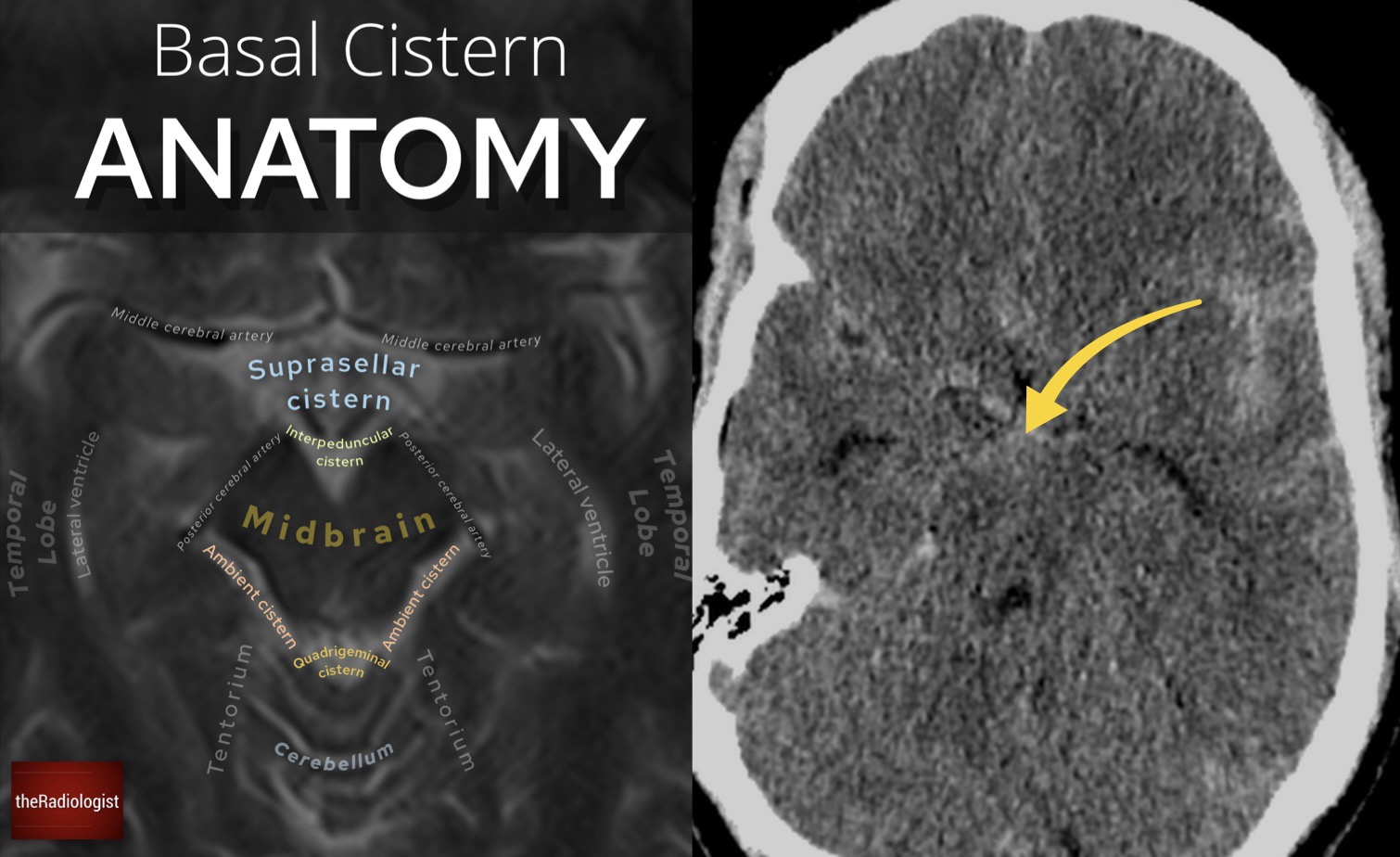 On call quiz 1 – the Radiologist