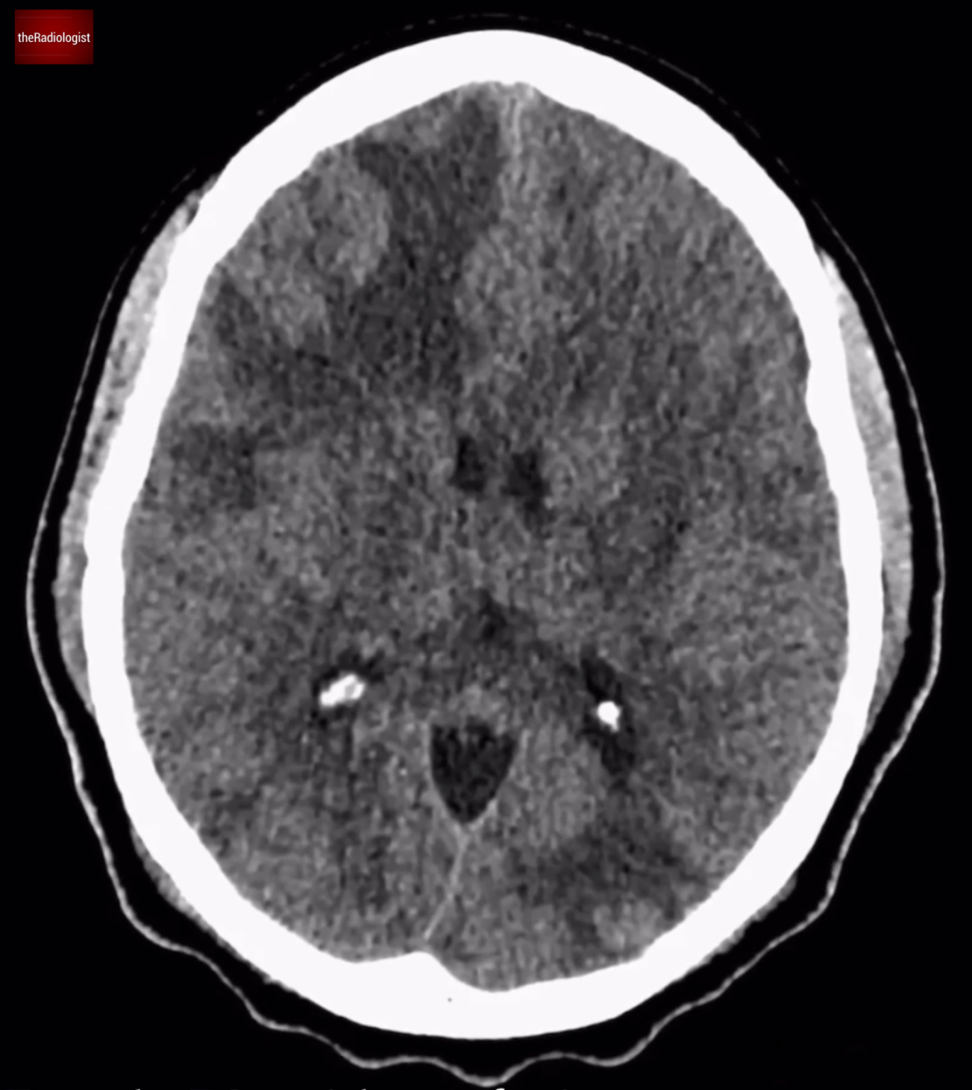 Space occupying lesions – the Radiologist
