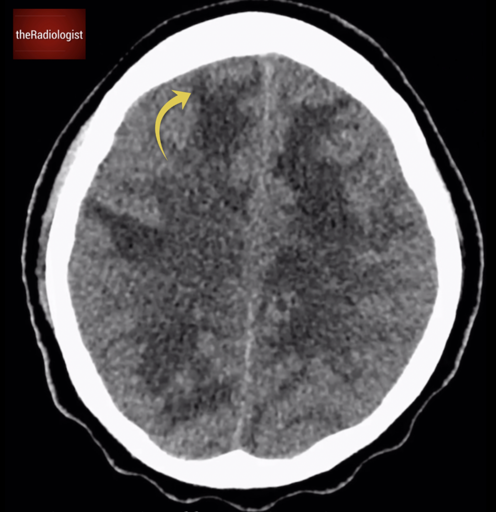 Space occupying lesions – the Radiologist