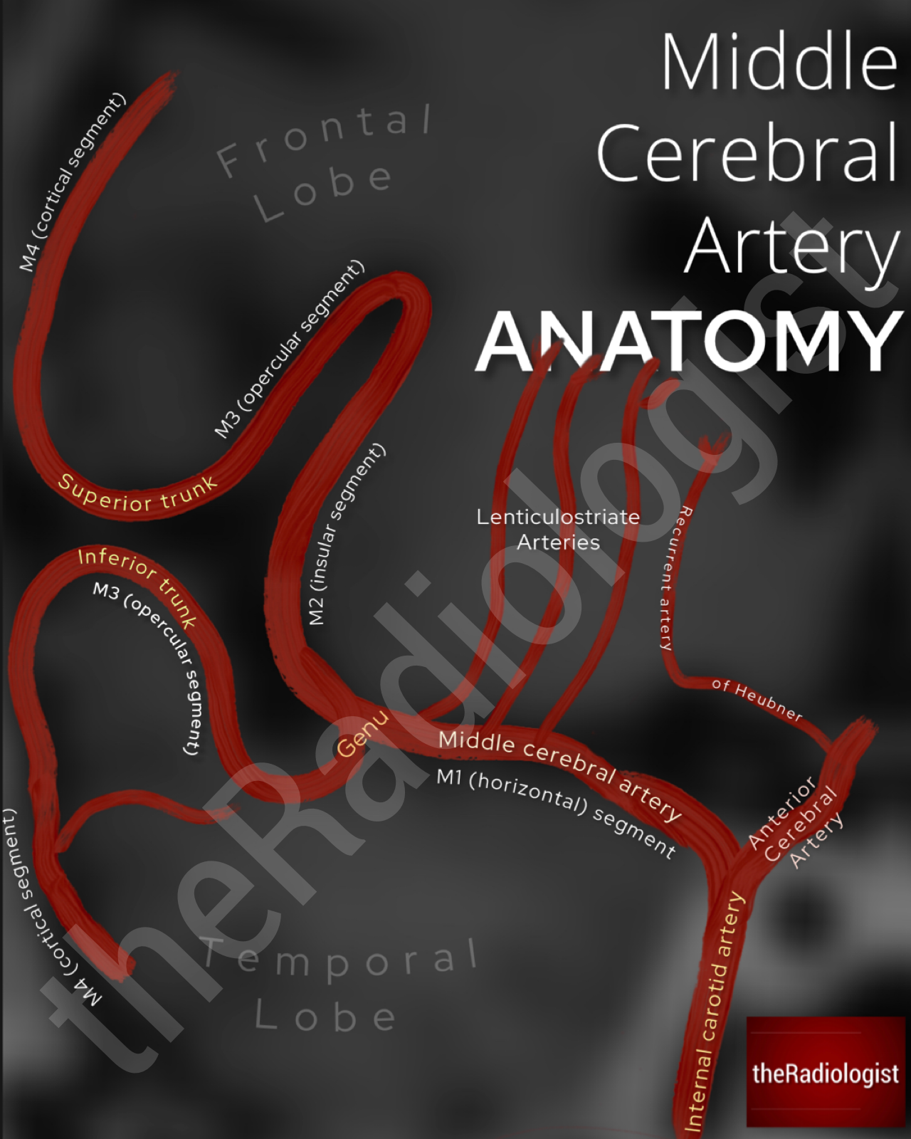 Early Mca Territory Infarcts The Radiologist