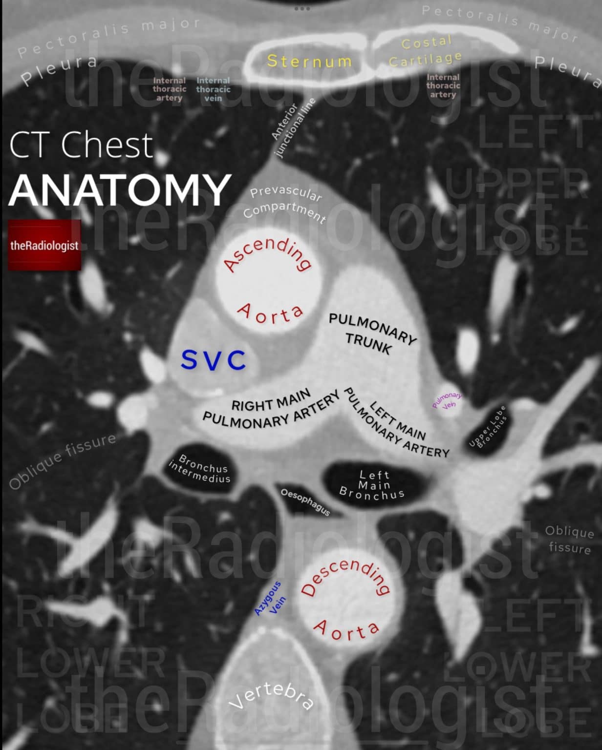 Pulmonary embolism - the Radiologist