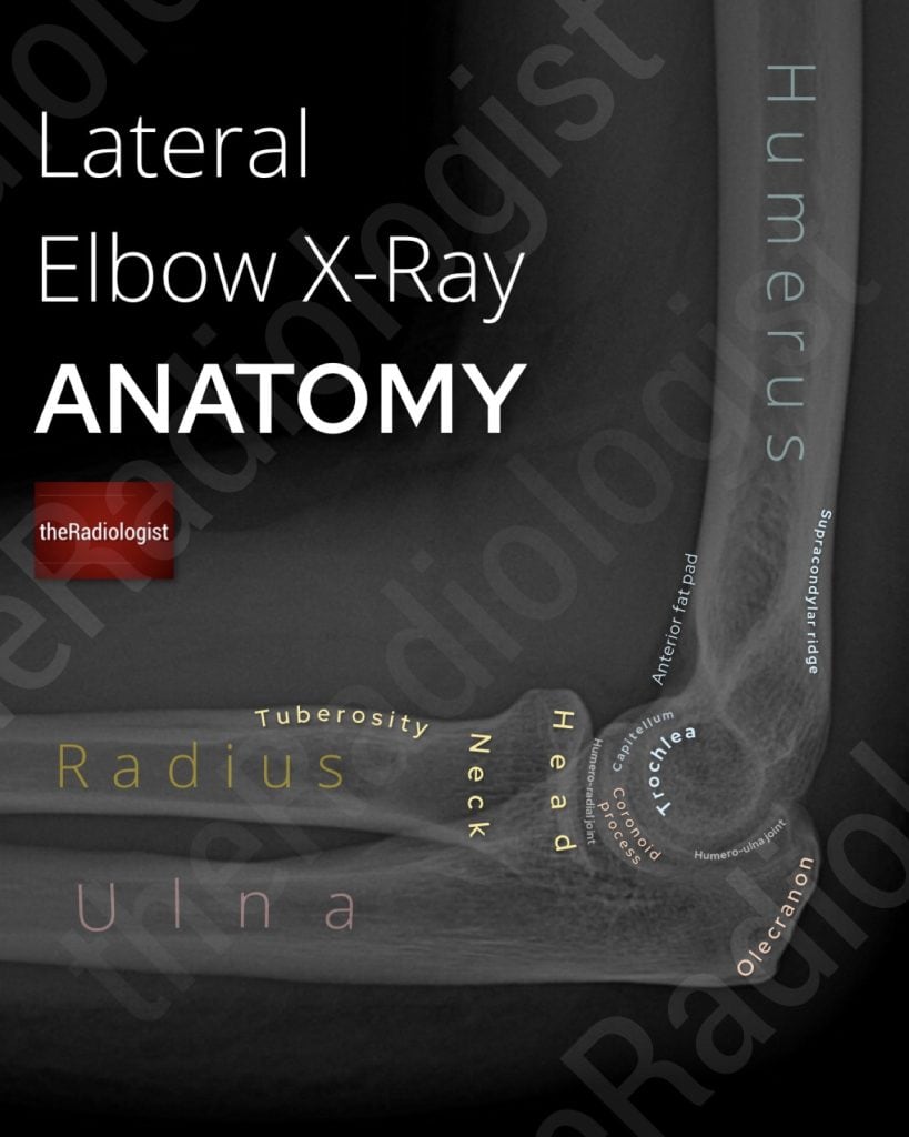 Elbow X-Ray Essentials – the Radiologist