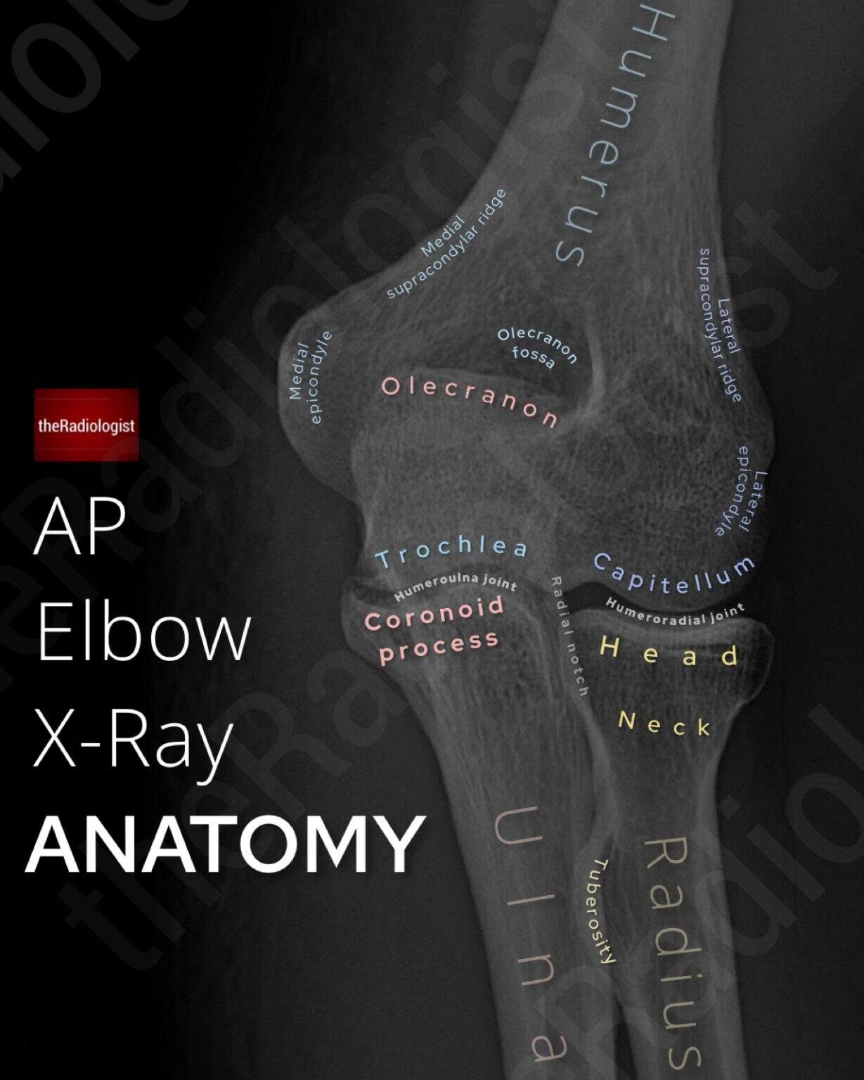 Elbow X-Ray Essentials – the Radiologist