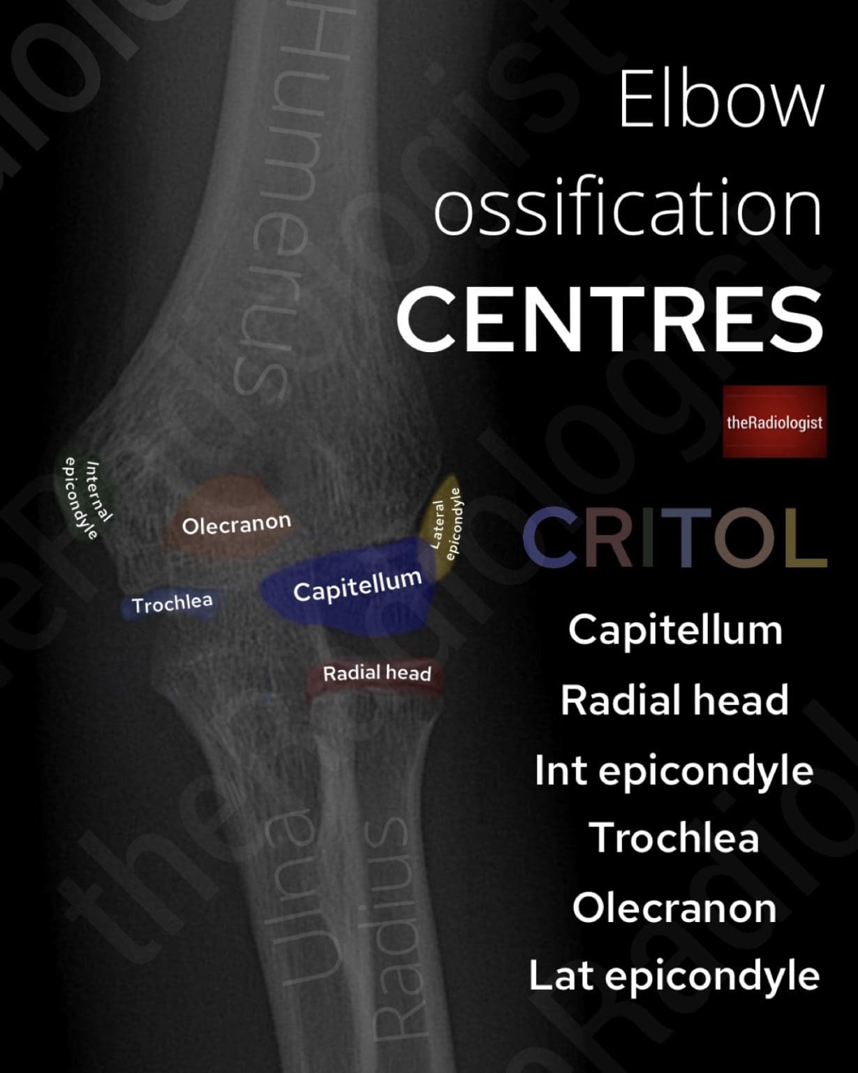 Elbow X-Ray Essentials – the Radiologist