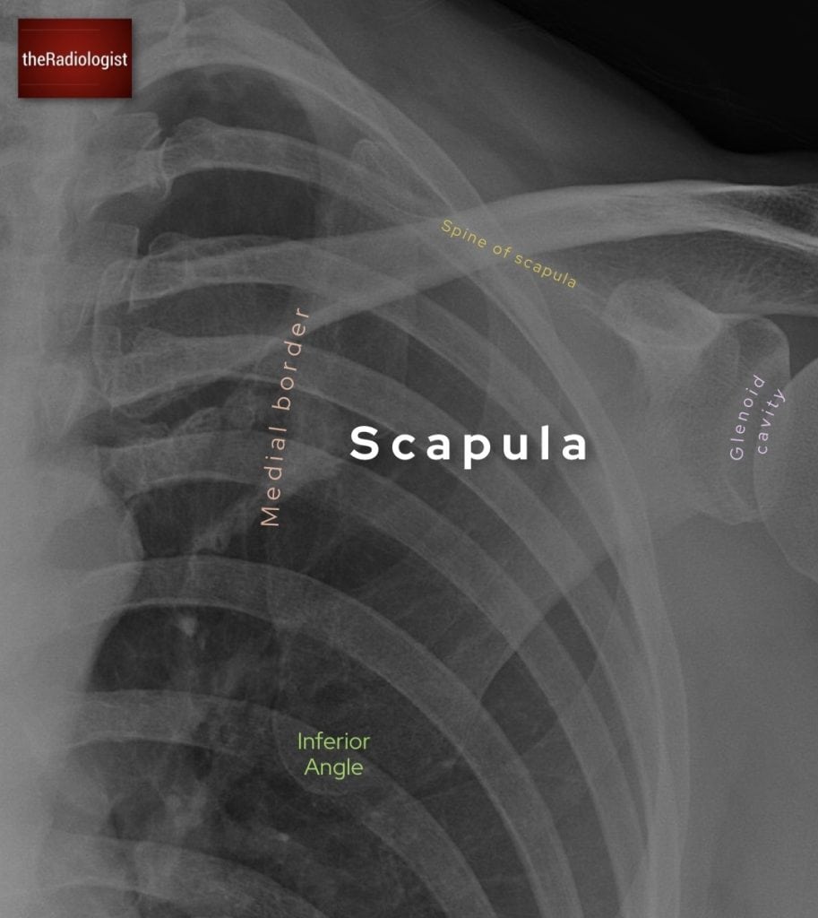 How to Read a Shoulder X-Ray | Anatomy and Views Guide