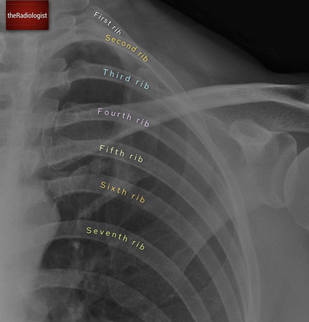 Shoulder X-Ray Essentials – the Radiologist