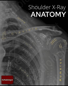How to Read a Shoulder X-Ray | Anatomy and Views Guide