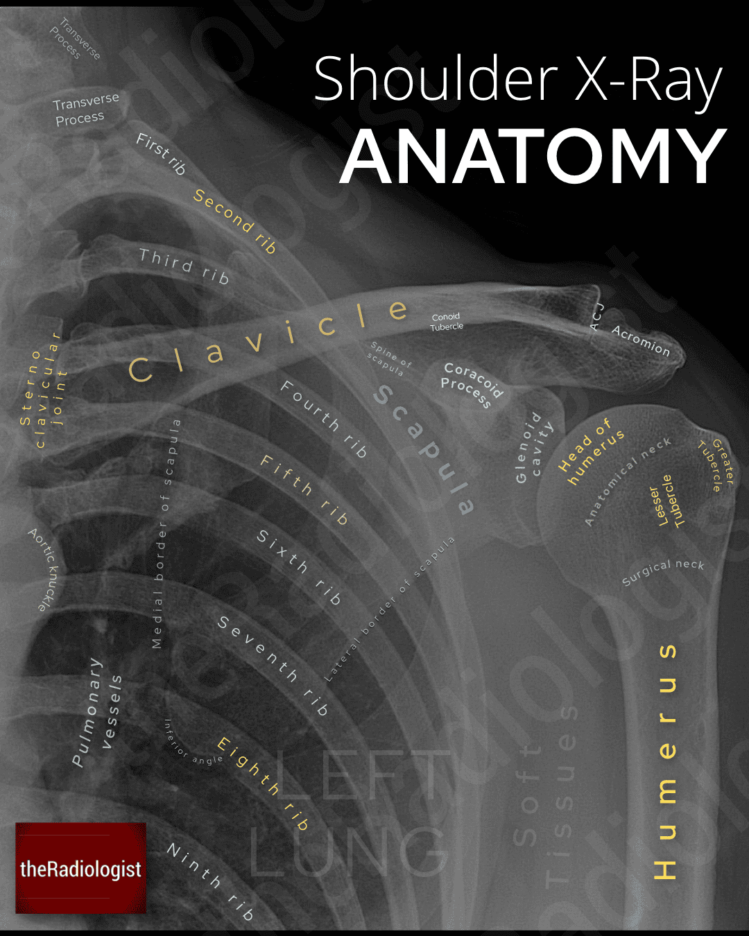 Shoulder X-Ray Essentials – the Radiologist