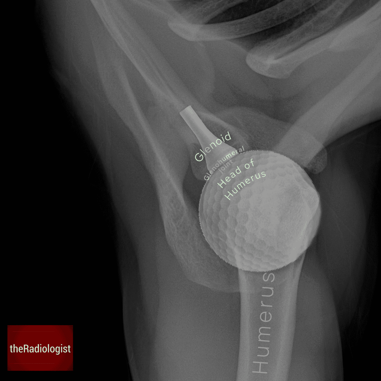 How to Read a Shoulder X-Ray | Anatomy and Views Guide