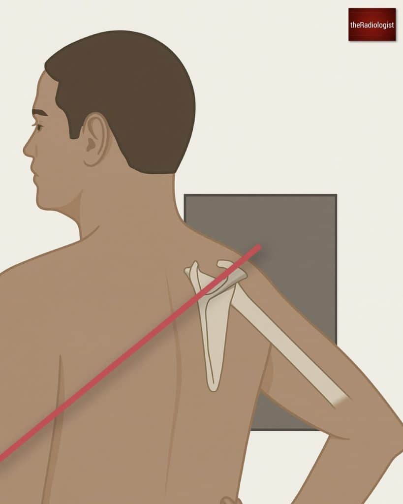 How to Read a Shoulder X-Ray | Anatomy and Views Guide