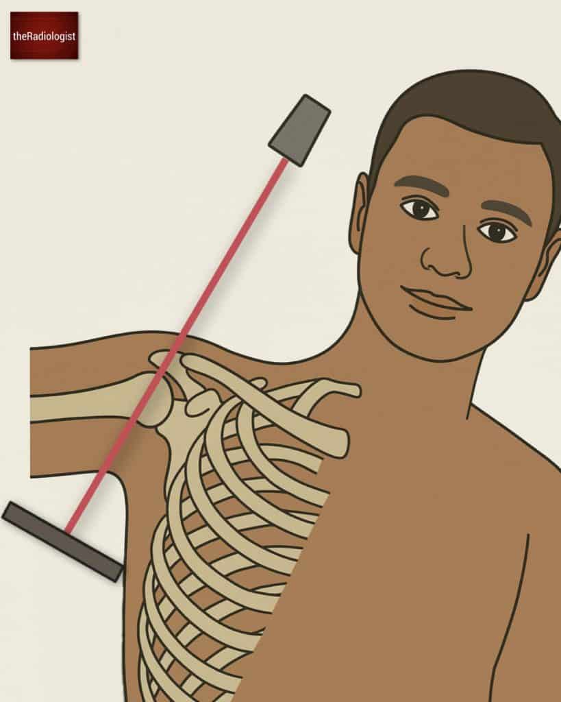 Shoulder X-Ray Essentials – the Radiologist