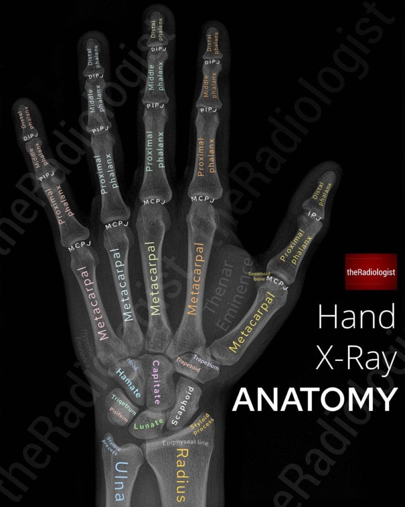 Hand and Wrist X-Ray Guide – the Radiologist