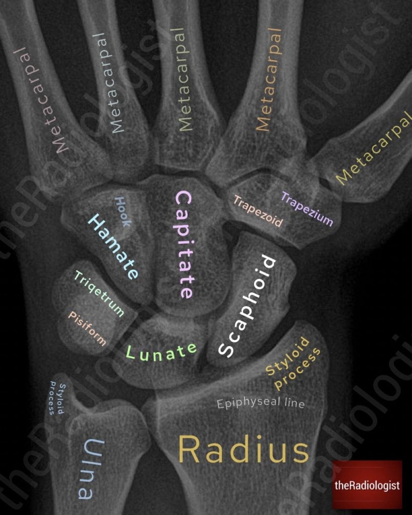 How to Read a Hand X-ray | Wrist Anatomy Guide