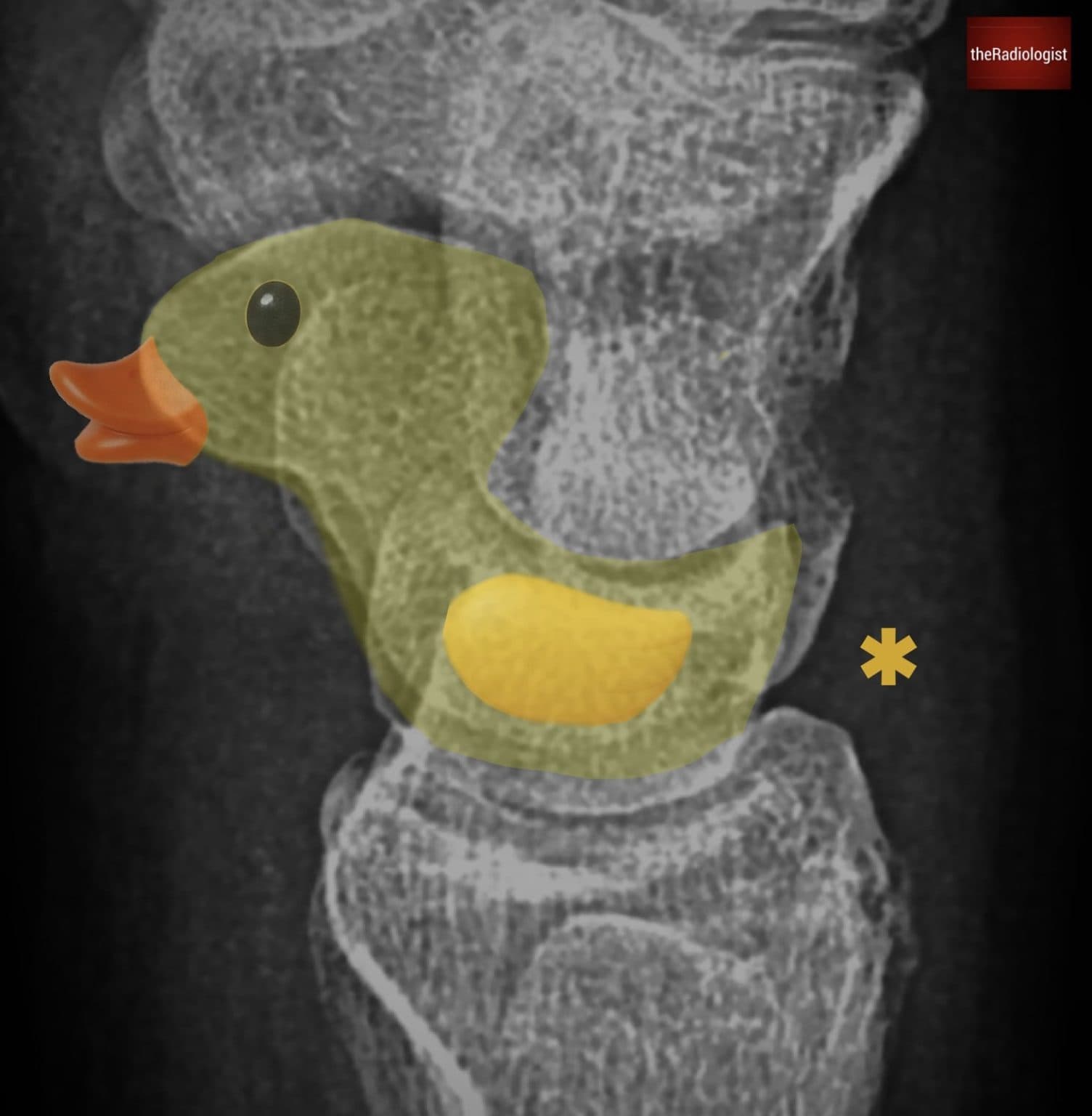 Hand and Wrist X-Ray Guide – the Radiologist
