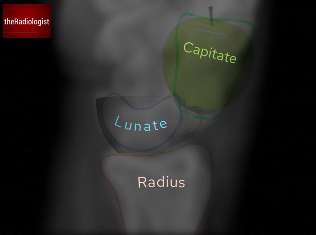 How to Read a Hand X-ray | Wrist Anatomy Guide