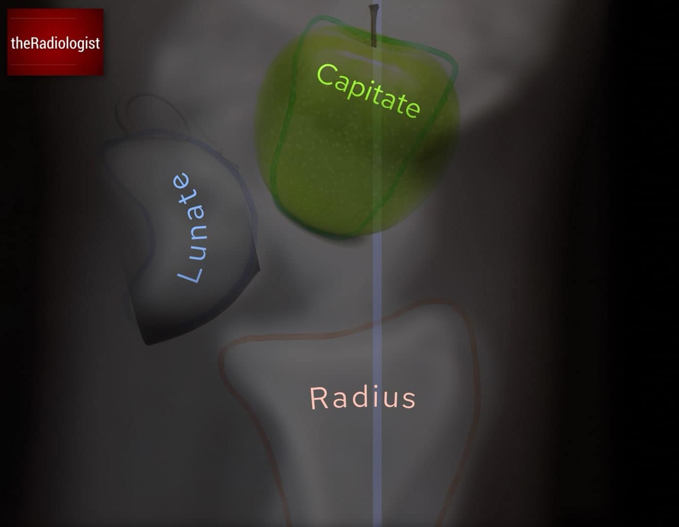 How to Read a Hand X-ray | Wrist Anatomy Guide