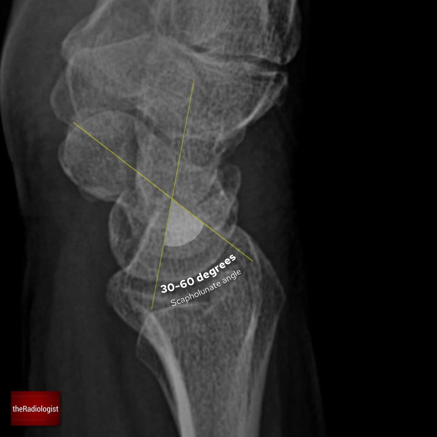 Hand and Wrist X-Ray Guide – the Radiologist