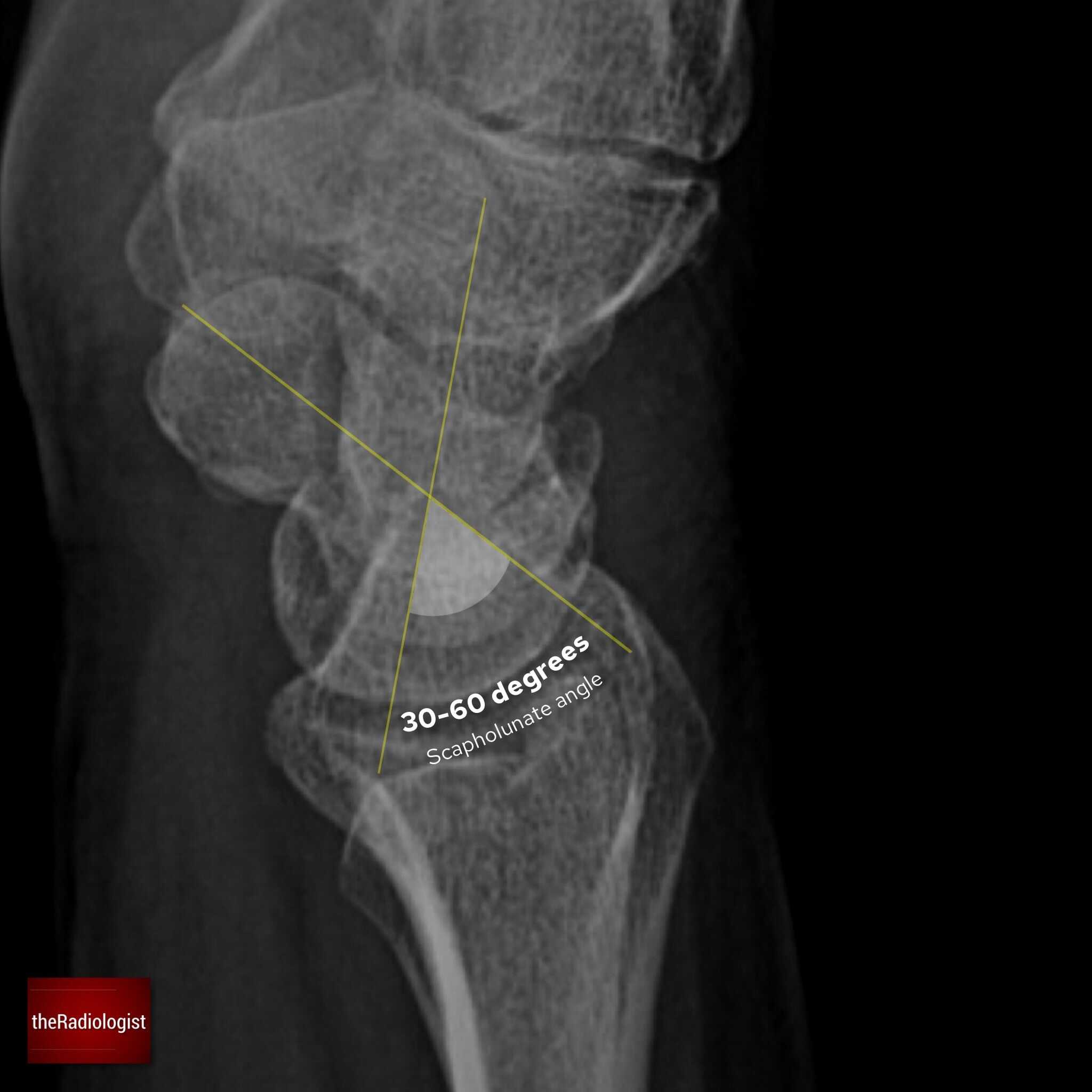 Hand and Wrist X-Ray Guide – the Radiologist
