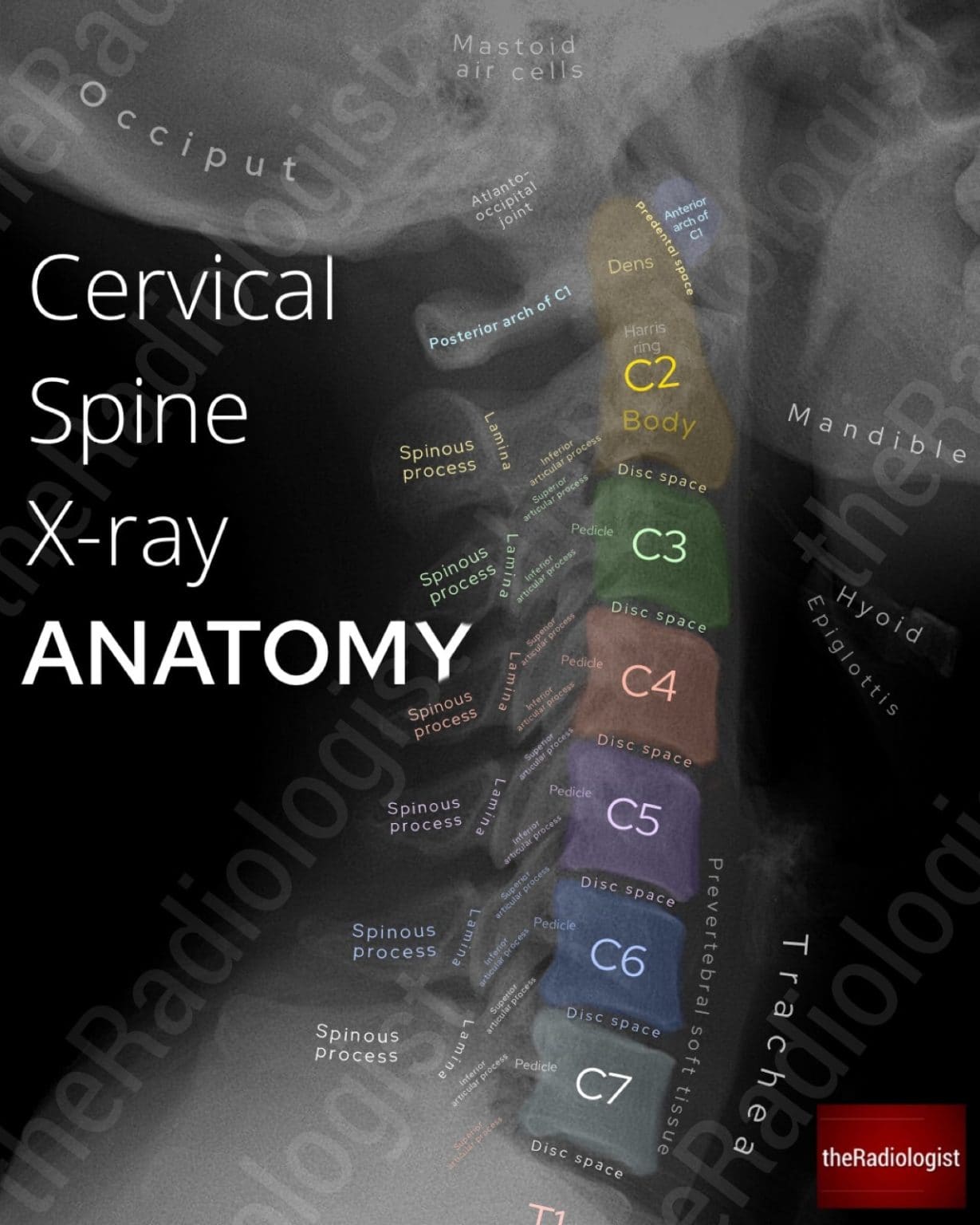 Cervical Spine X-Ray Essentials – the Radiologist
