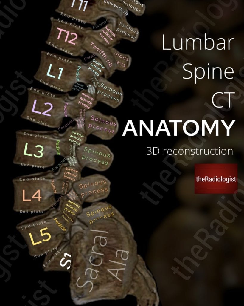 How to Read a Lumbar Spine X-Ray | AP and Lateral Guide
