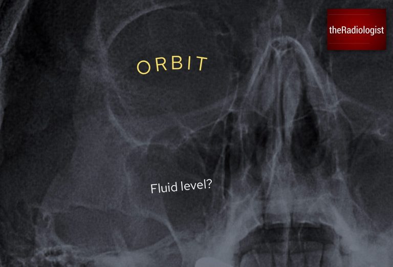 Facial bone X-Ray Guide – the Radiologist