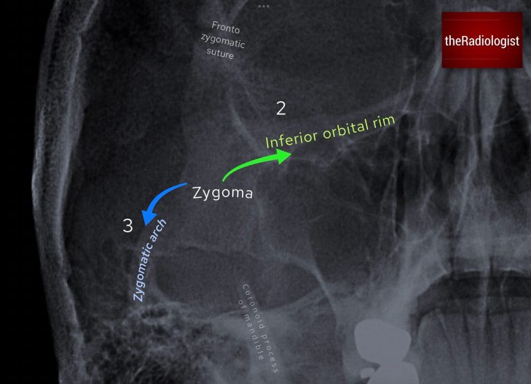 Facial bone X-Ray Guide – the Radiologist