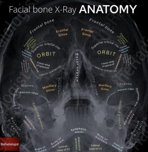 How to Read a Facial Bone X-ray | Anatomy Guide