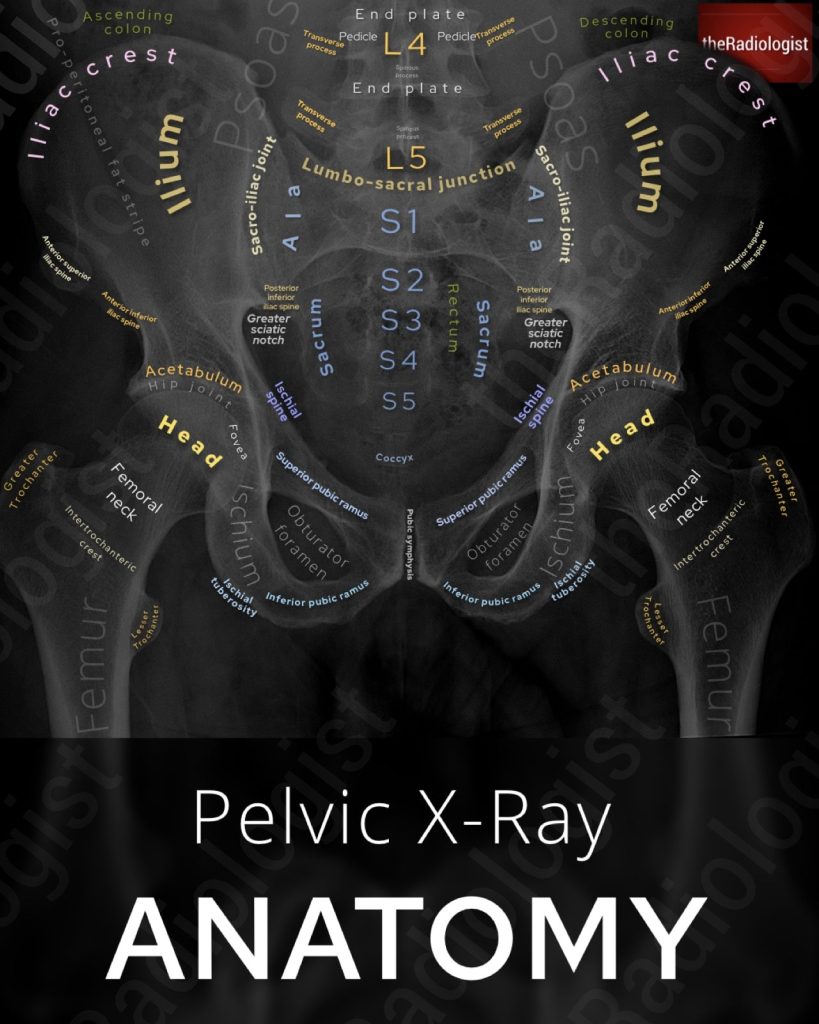 Pelvic X-Ray Guide – the Radiologist