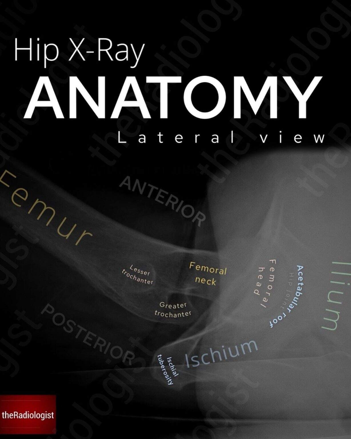How to Read a Pelvis X-Ray | Anatomy and Trauma Guide
