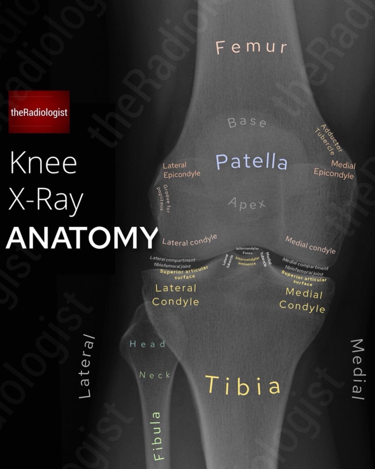 Knee X-Ray Guide – the Radiologist