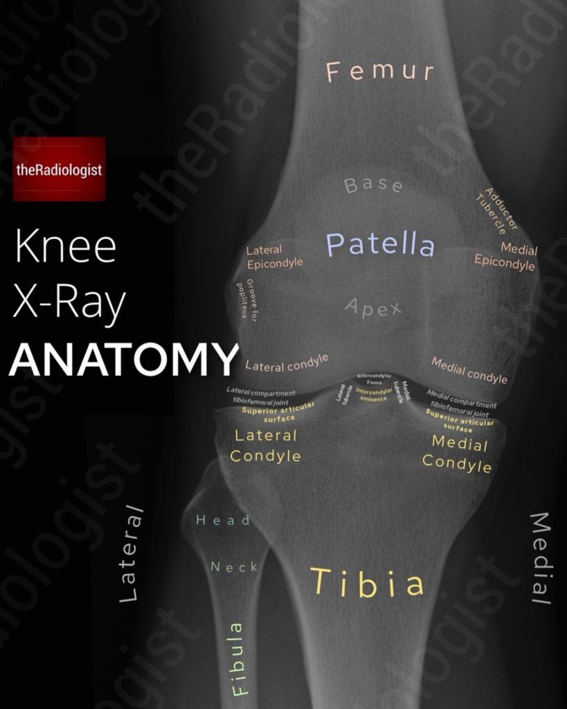 Knee X-Ray Guide – the Radiologist