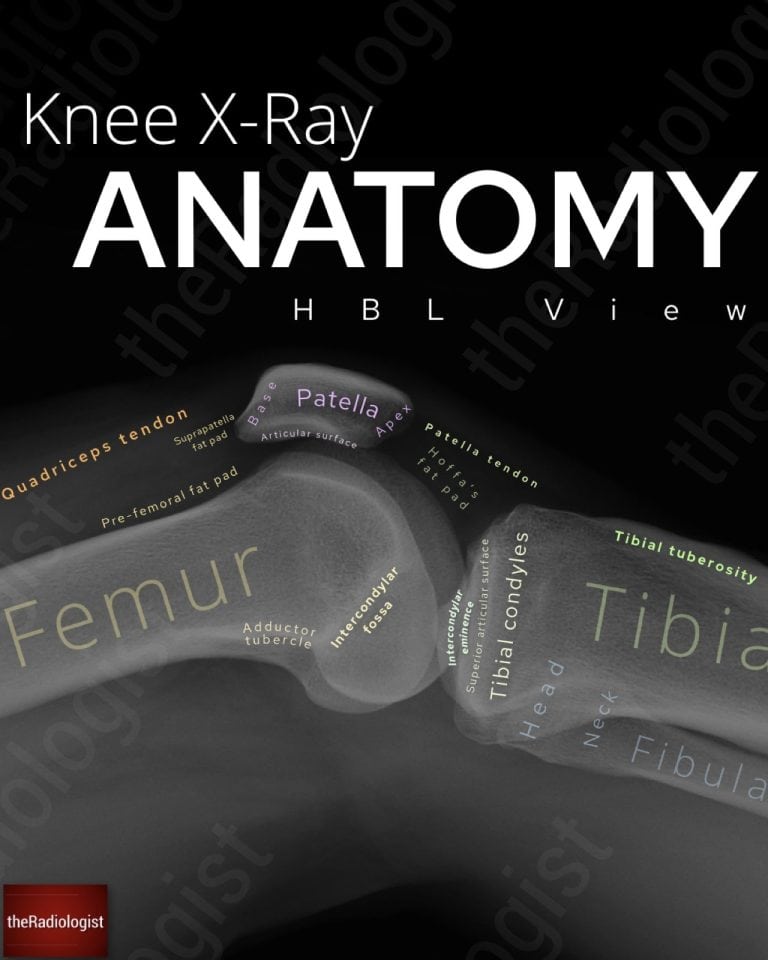 How to Read a Knee X-Ray | Anatomy and Alignment Guide