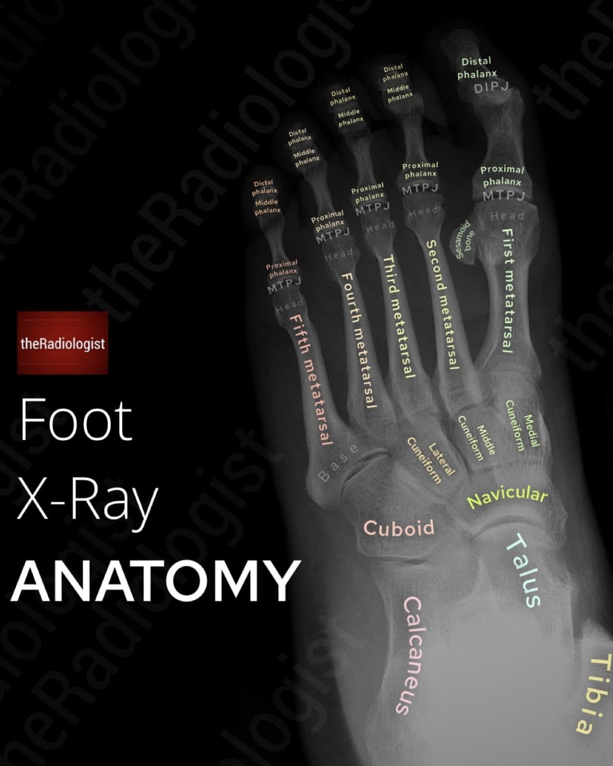How to Read a Foot X-ray | Anatomy & Ankle Guide