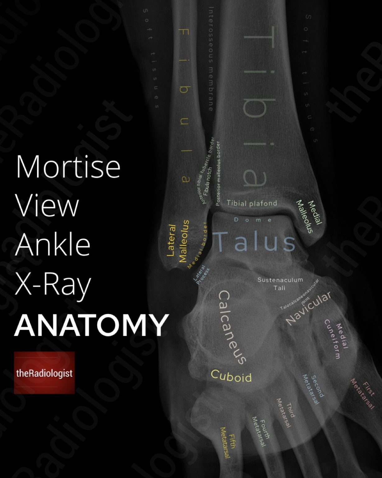 Foot and Ankle X-Ray Guide – the Radiologist