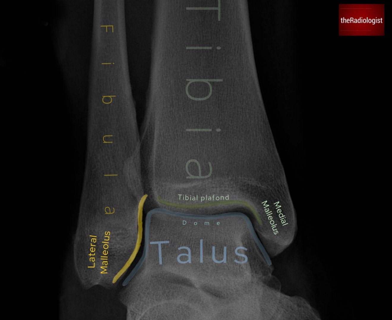 Foot and Ankle X-Ray Guide – the Radiologist