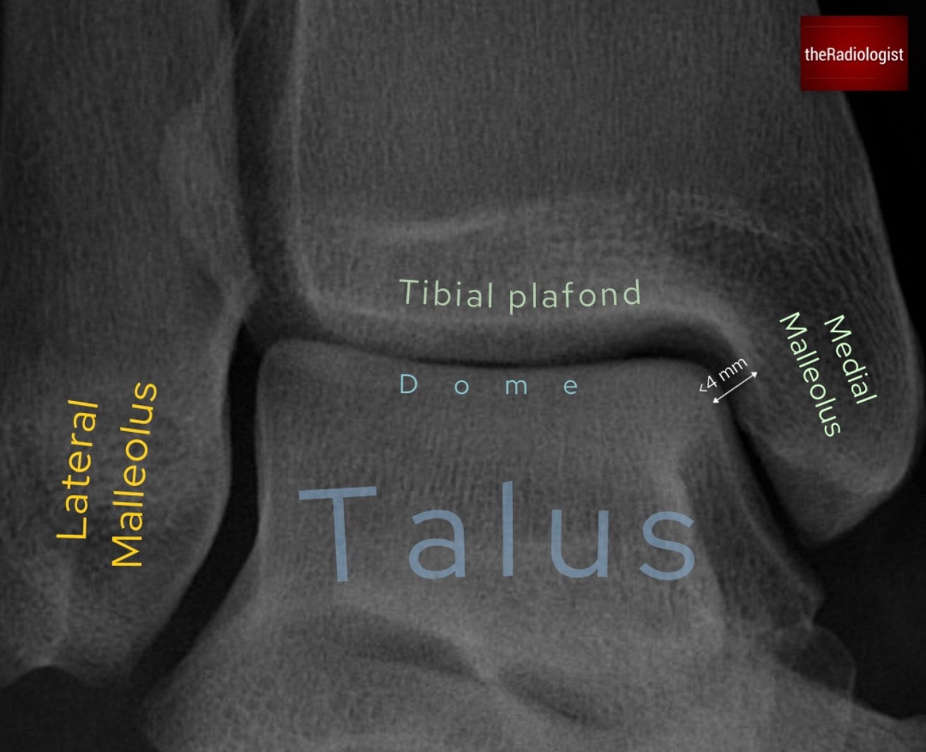 Foot and Ankle X-Ray Guide – the Radiologist