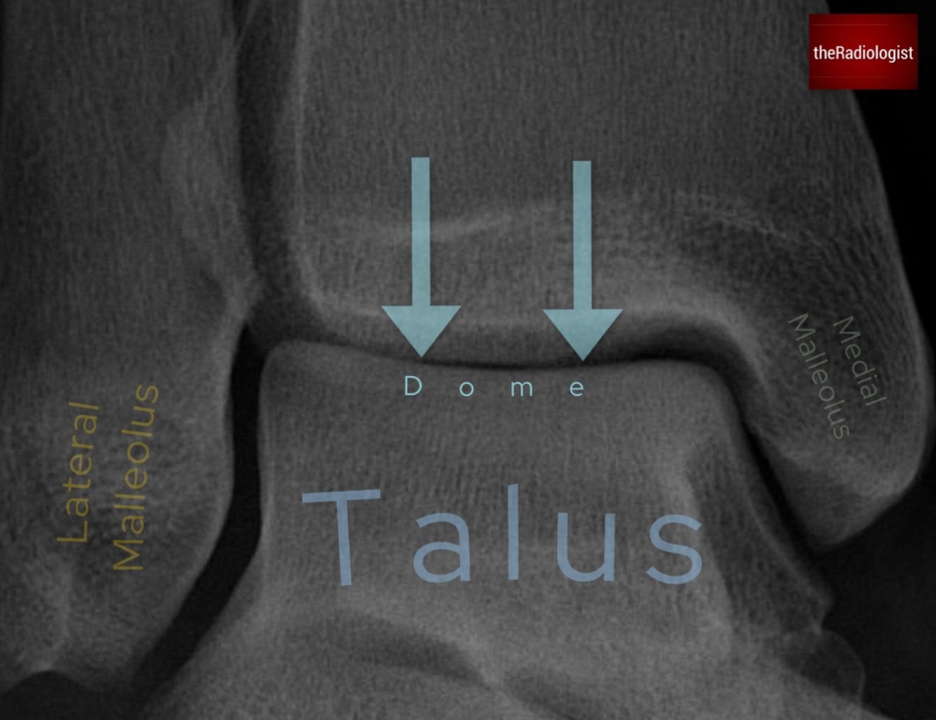 Foot and Ankle X-Ray Guide – the Radiologist
