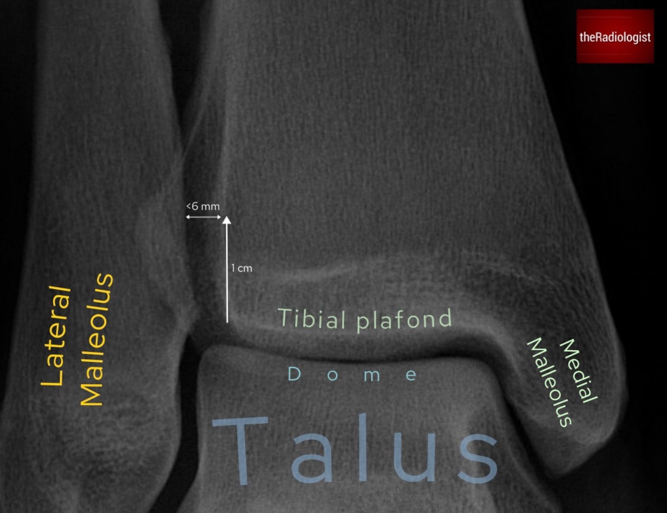 Foot and Ankle X-Ray Guide – the Radiologist