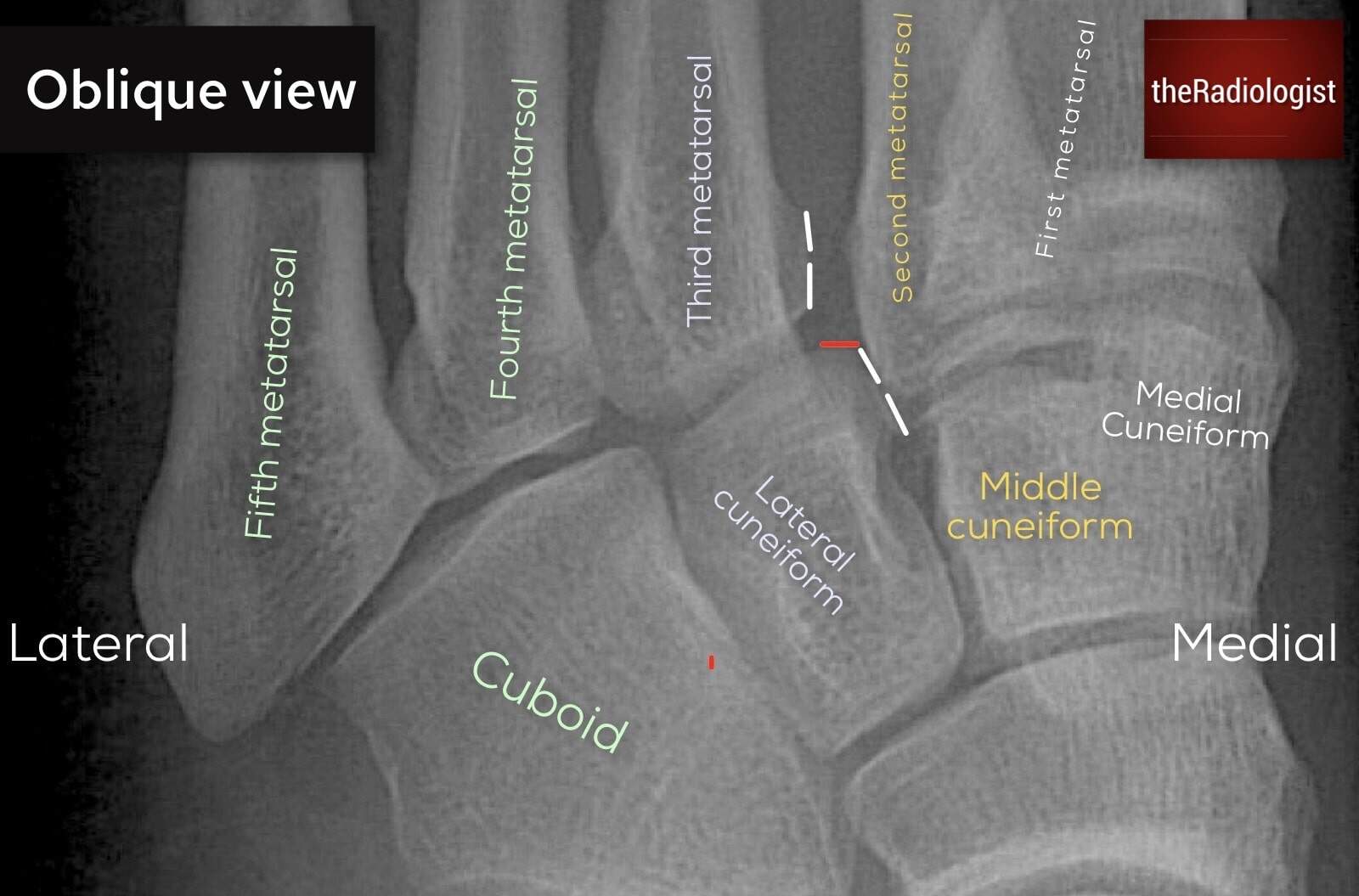 Foot and Ankle X-Ray Guide – the Radiologist