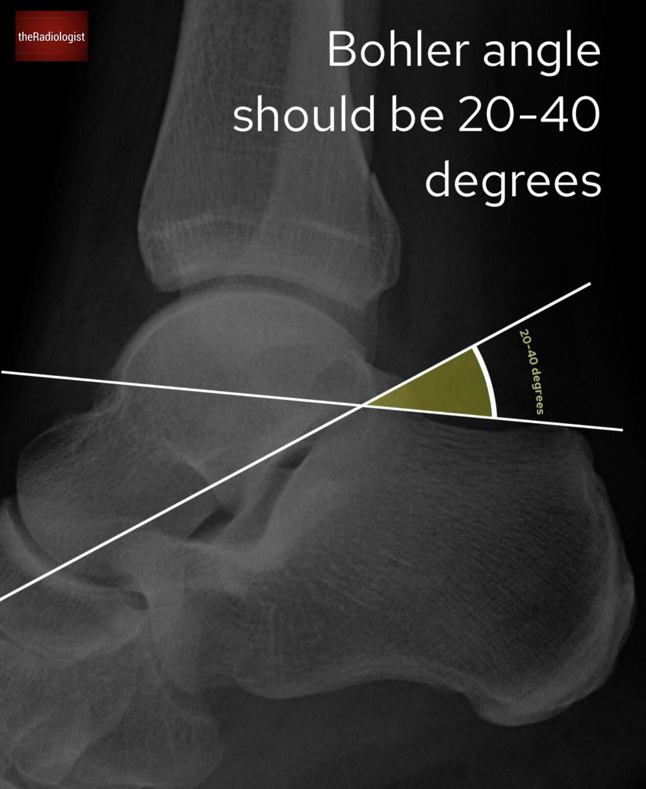 Foot and Ankle X-Ray Guide – the Radiologist