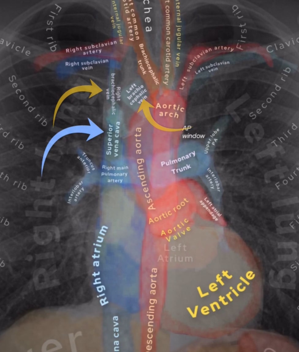 Chest X-Ray Review Areas – the Radiologist