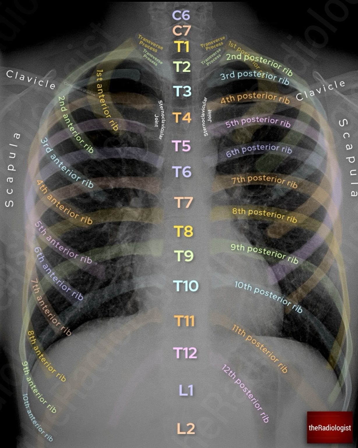 The Radiologist Anatomy Gallery | Annotated Radiology Anatomy