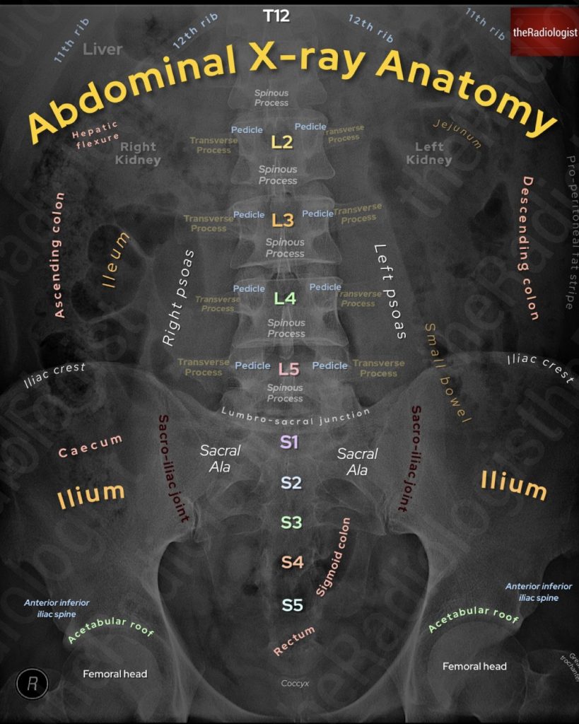 Abdominal X-Ray review areas – the Radiologist