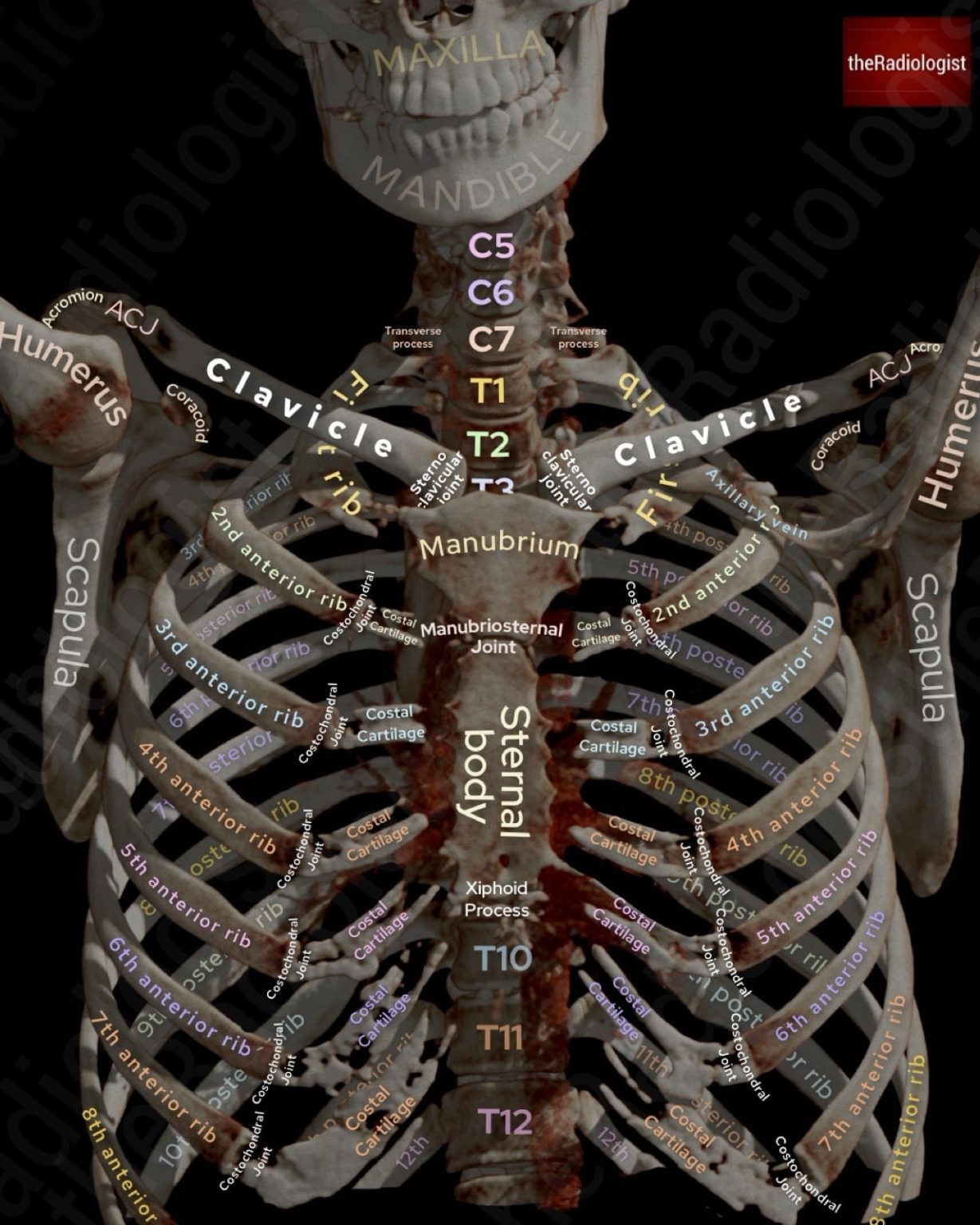 Chest X-Ray Review Areas – the Radiologist