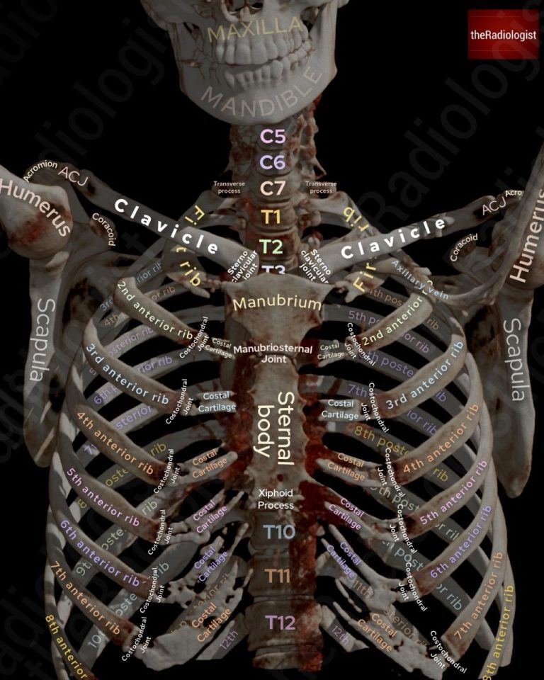 How to Read a Chest X-ray | CXR Interpretation Guide